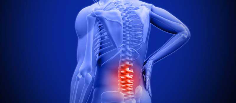 Οδηγός για Οσφυαλγία: Ταξινόμηση, Αίτια και Τρόποι αντιμετώπισης ...