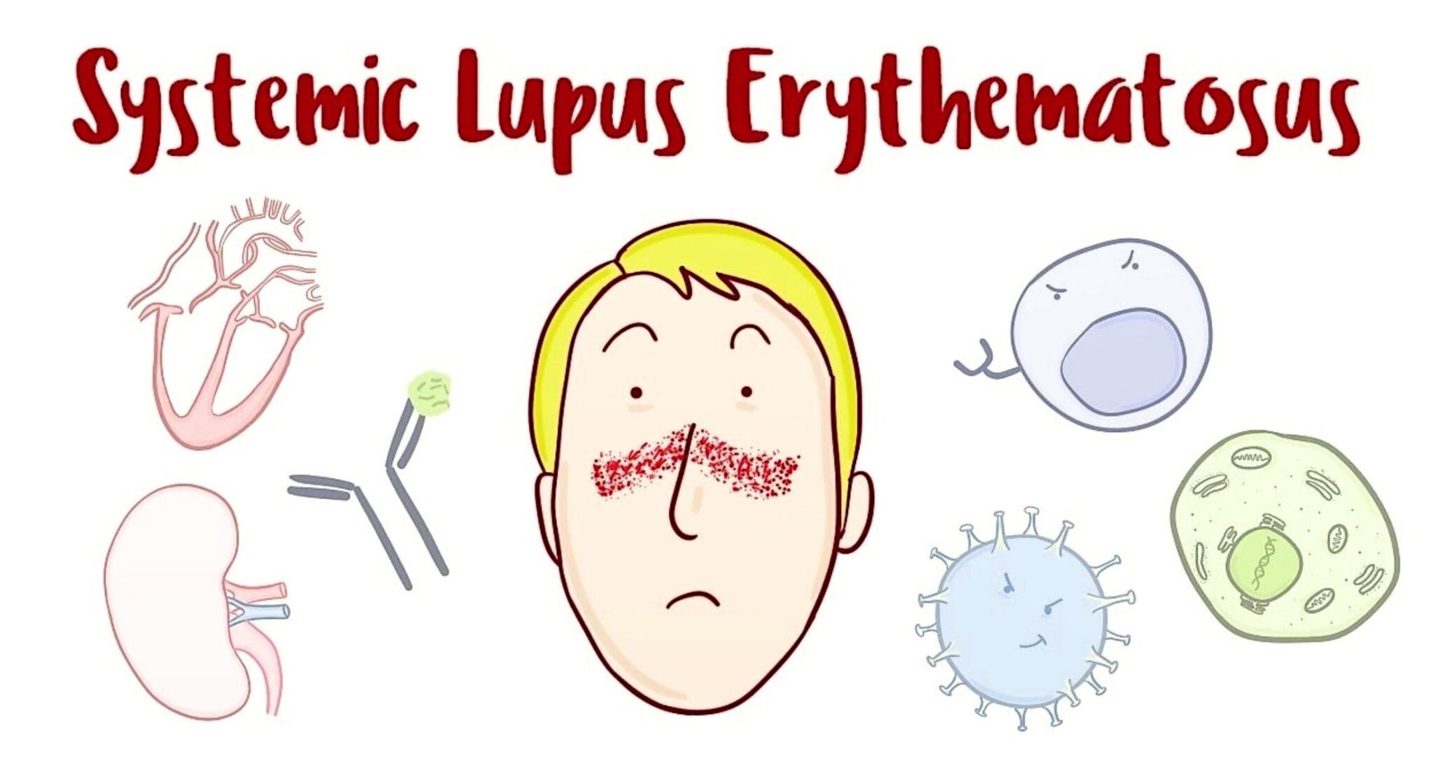 Κατανοώντας τον Συστηματικό Ερυθηματώδη Λύκο - Truemed.gr