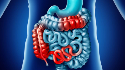 Νόσος του Crohn και νοσηλευτικές παρεμβάσεις - Truemed.gr